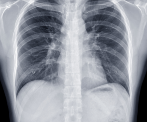 Radiant Health, Rapid Results: Embracing In-House X-rays at Ross Bridge ...